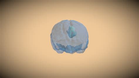 Mr Brain Tumors Segmentation Download Free 3d Model By Jcgilmas C376e39 Sketchfab