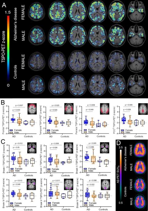 Munich Cluster For Systems Neurology Synergy On Linkedin Associations Between Sex Body Mass
