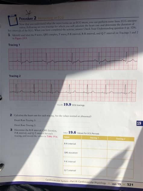Solved Procedure 1 Identifying Waves Of An Ecg Lets Start