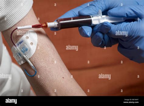 Picc Line Hi Res Stock Photography And Images Alamy