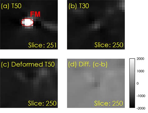 Sample Outlier Results Deformed By The Original Horn And Schunck