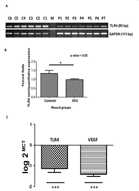 Semi Quantitative Reverse Transcriptase Polymerase Chain Reaction Download Scientific Diagram