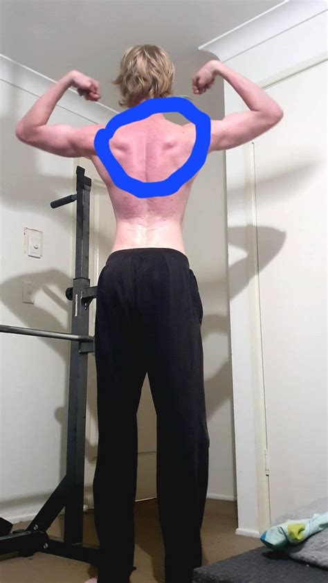 Nucleus Overload On Traps Rteam3dalpha