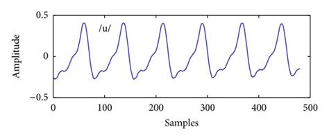A C And E Sustained Vowels A I And U From Pathological Download Scientific