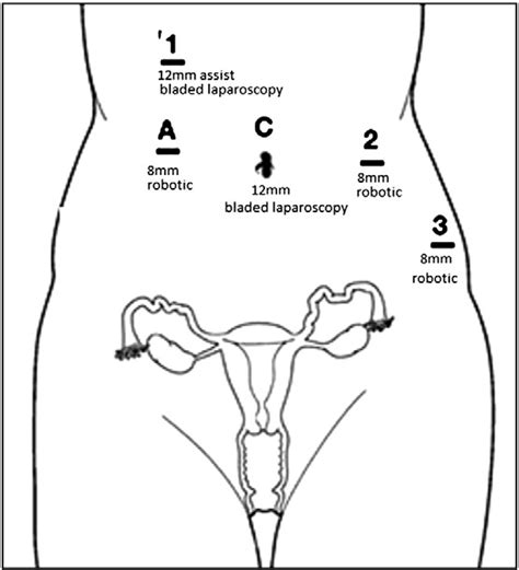 I Started Something Diagrammatic Representation Of Port Information