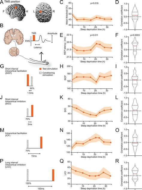 Cortical Excitability Signatures For The Degree Of Sleepiness In Human ELife
