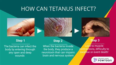Tetanus Awareness Youtube