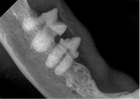Tooth Reabsorption Flashcards Quizlet