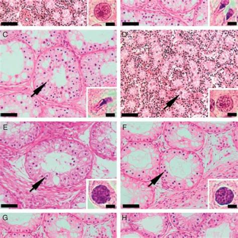 Immunohistochemistry For The Gonocyte And Spermatogonia Marker Uch L1 Download Scientific