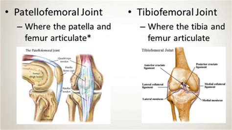 What Is The Patellofemoral Joint