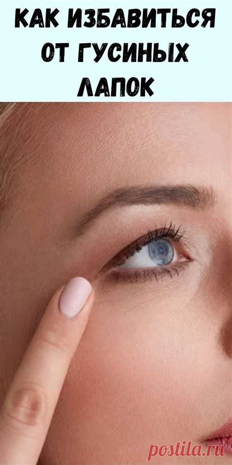 Как избавиться от гусиных лапок Упражнения и похудение Упражнения и похудение Постила