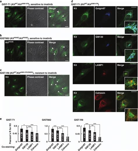 In Gist Cell Lines Kit Mut Localizes Preferentially On The Golgi