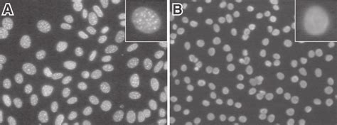 In Vitro Characterization Of The Rb− −pre Cell Line The Punctate Download Scientific Diagram