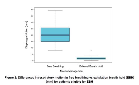Quantification Of Motion Reduction Using Pre Simulation Assessment Sessions Pass For