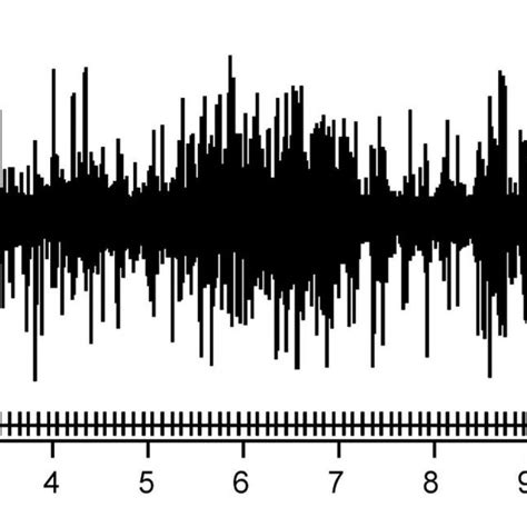 An Example Of A Rabbit Electroencephalogram Eeg Activity