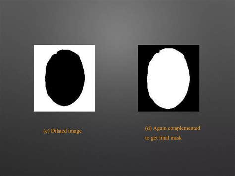 Brain Tumor Detection Pptx