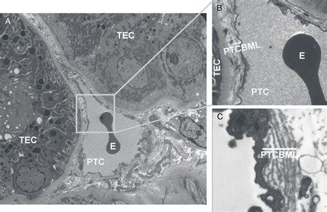 Peritubular Capillary Basement Membrane Multilayering In Ren