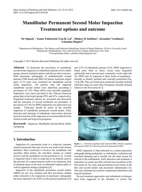 Pdf Mandibular Permanent Second Molar Impaction Treatment Options And Outcome