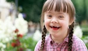 Cute Girl With Down Syndrome By Fdew3 On Deviantart