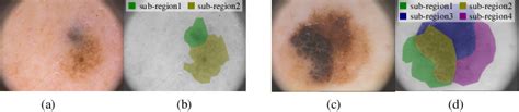 Figure 1 From Unsupervised Skin Lesion Segmentation Via Structural