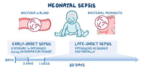 Evidence Based Management Of Neonatal Sepsis Early Recognition To Targeted Therapy