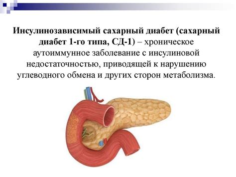 Инсулинозависимый сахарный диабет - online presentation