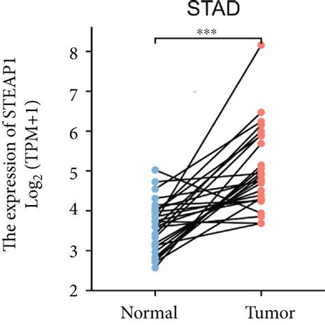 A The Differences Of Steap1 Expression Level Between Normal And Tumor