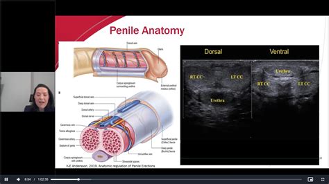 The Value Of Penile Ultrasound In Ed Diagnosis Excel Male Trt Forum