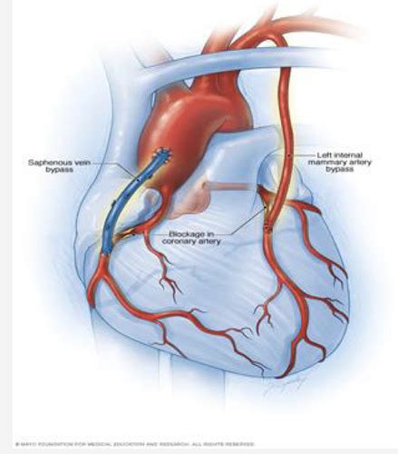 Surgery Survey Of Common Surgical Procedures Flashcards Quizlet