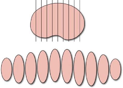 Sentinel Lymph Node Parallel Slices Are Perpendicular To The Long Axis