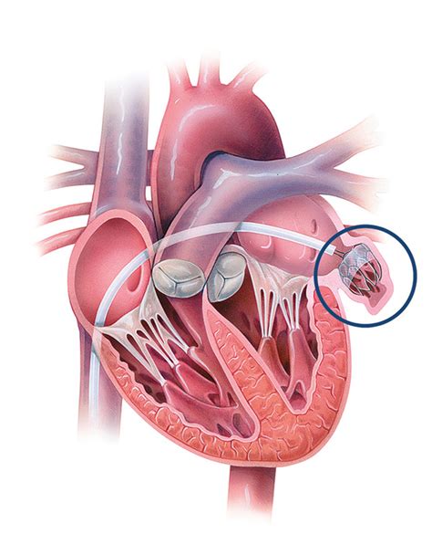Left Atrium