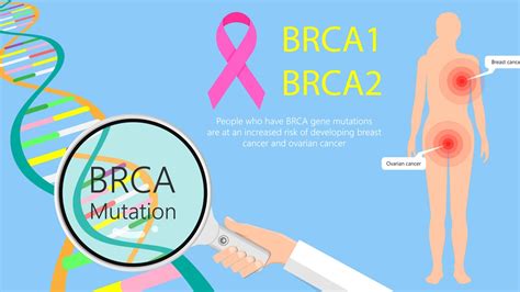 What Is Brca Gene Mutation When And Who Should Get Tested For It