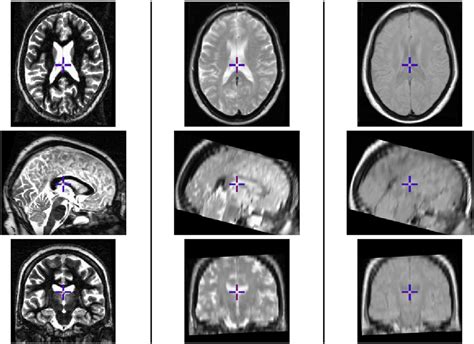 Figure 1 From Multi Spectral Brain Tissue Segmentation Using