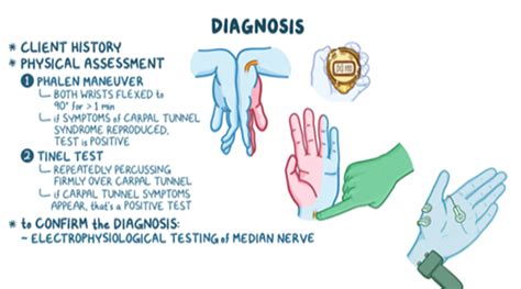 Nclex Rn® Question Of The Day Carpal Tunnel Osmosis Blog