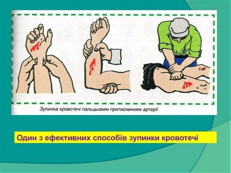 Надання першої домедичної допомоги потерпілим презентация онлайн