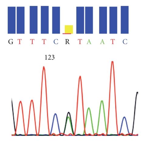 Kit Exon 10 Point Mutation 1609 G→a Resulting In The Amino Acid Download Scientific Diagram