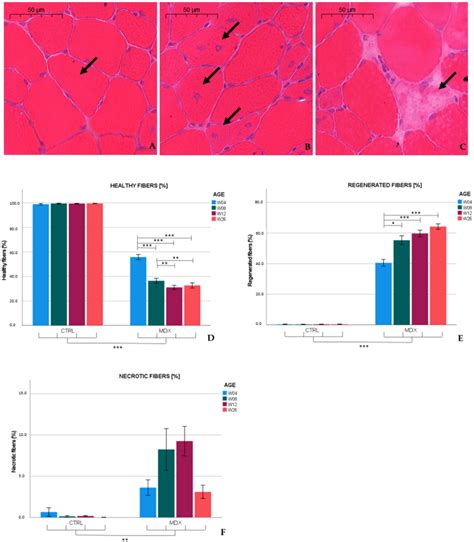 Figure 1 From Description Of Osmolyte Pathways In Maturing Mdx Mice Reveals Altered Levels Of
