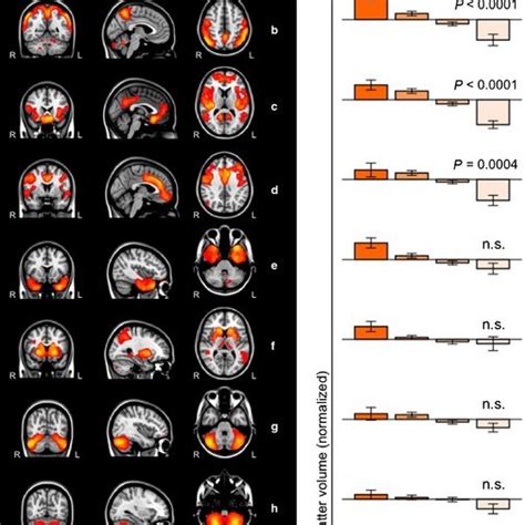 Gray Matter Structural Networks And Associations With Age A Overview