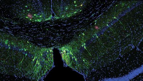 E11 Bio On Linkedin 📢 E11 Is Looking For An Ambitious Ra To Join Our