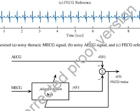 Adaptive Noise Canceller Block Diagram Used For The Proposed Algorithm