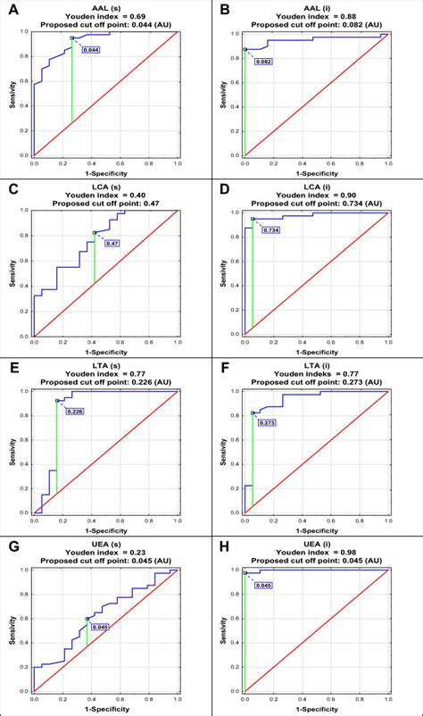 Receiver Operating Characteristic Curve Analysis Of Serum Native Igg