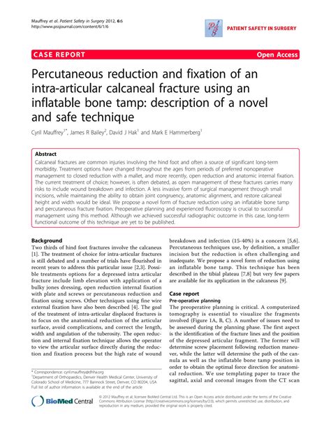 Solution Percutaneous Reduction And Fixation Of An Intra Articular Calcaneal Fracture Using An