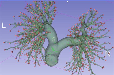 Vmtk Centerlinesnetwork Metrics Support 3d Slicer Community