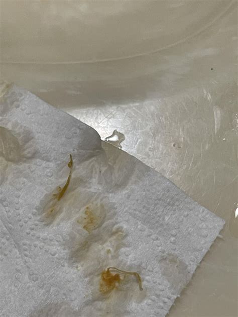 Ive Had Bad Constipation Now This Things Are Showing Up On My Stool