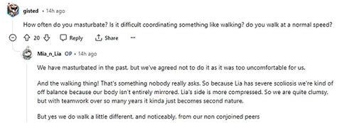 Conjoined Twins Who Share A Vagina But Have Different Sexualities