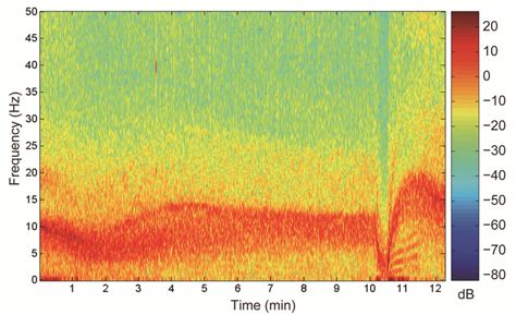 A Spectrogram Analysis From Electrocardiogram Ecg Signal Obtained Download Scientific Diagram