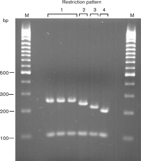 Types Of Tcdc Deletion Found In The Variant Toxinotypes Although The Download Scientific