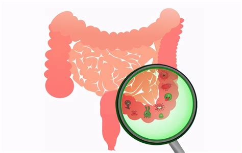 Treatment Of Acute Radiation Enteritis By Intragastric Administration
