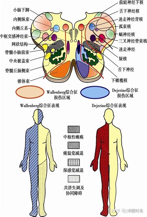 间脑与脑干的解剖生理及病损的定位诊断，一文详解！ 知乎