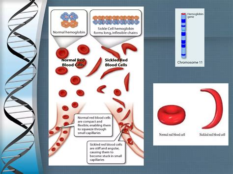 Genetic Disorder Ppt